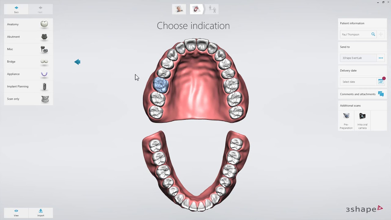 3Shape TRIOS - Order Creation IT - YouTube