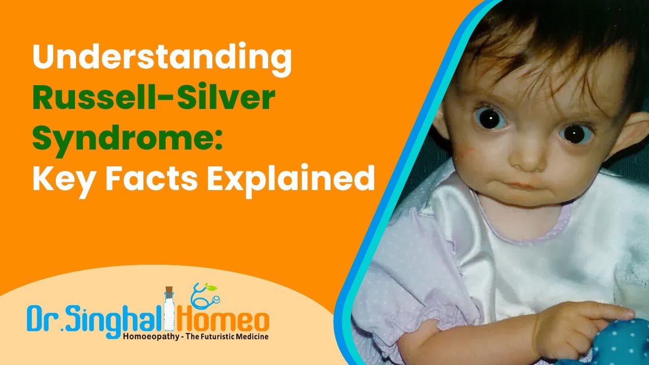 Russel Silver Syndrome and Homeopathy - YouTube