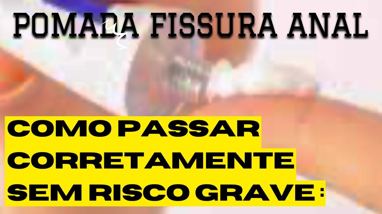 Proctologista Ensina C Passar Pomada Manipulação Para Fissura Anal Sem