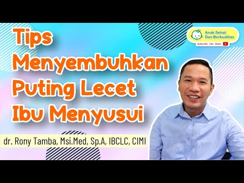 Puting Ibu Lecet Ketika Menyusui, Apa Yang Harus Ibu Lakukan ?