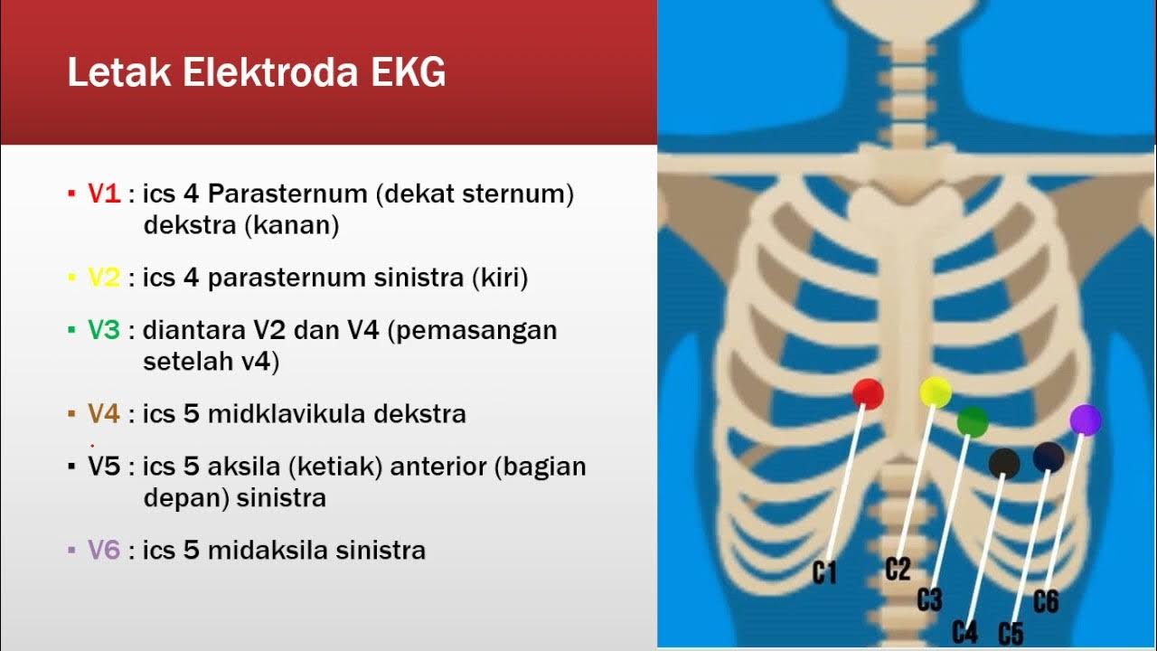 Cara dasar interpretasi EKG (Elektrokardiogram) - YouTube