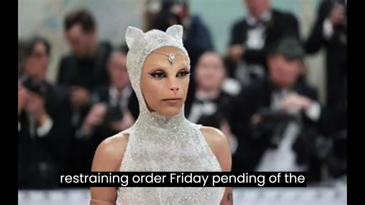 Doja Cats Brother Accused Of Knocking Her Teeth Out In Lawsuit