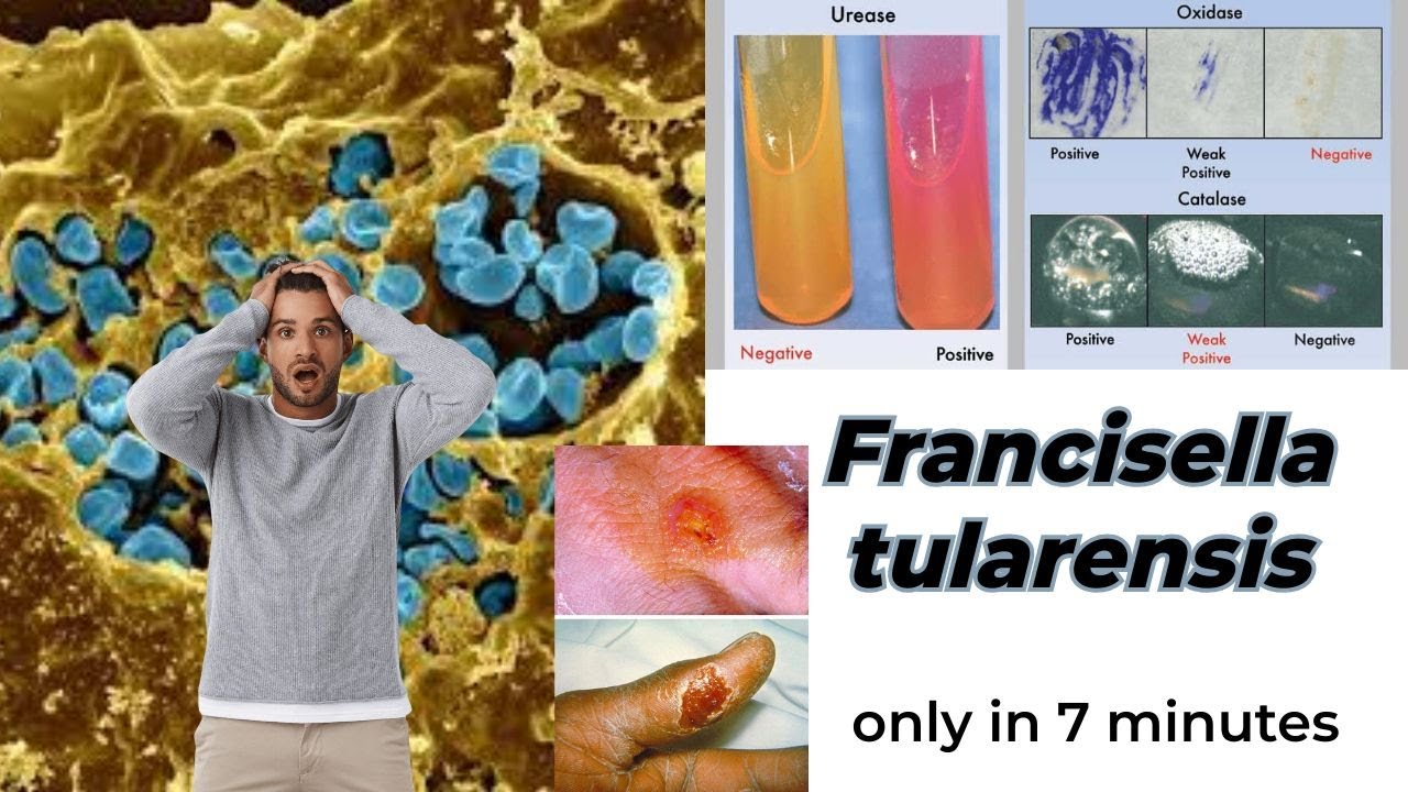 Francisella microbiology lecture || Francisella tularensis ||Easy ...