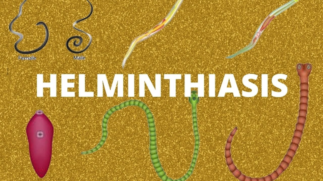 HELMINTHIASIS - YouTube