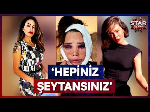 Survivor Didem Bir Kez Daha Ameliyat Oldu! Estetik Sonrası Sargılar İçinde Gözyaşlarına Boğuldu