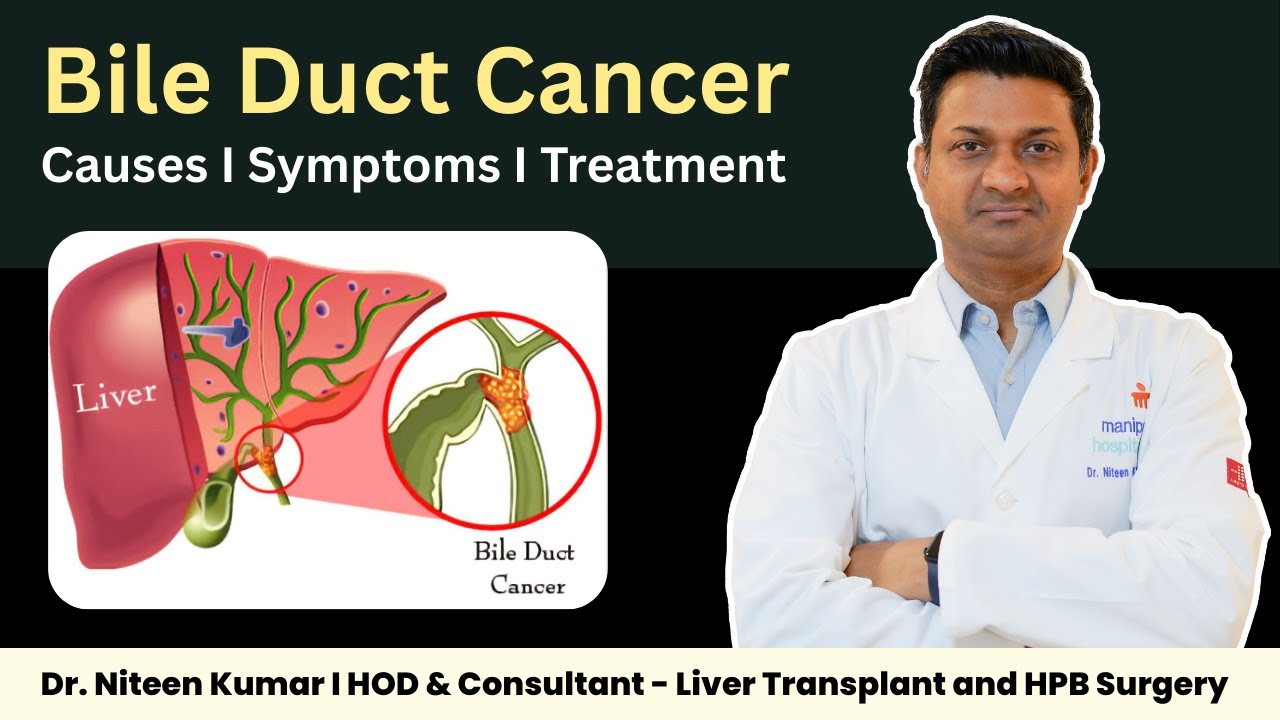 Bile Duct Cancer के लक्षण क्या हैं? | Bile Duct Cancer क्यों होता है ...
