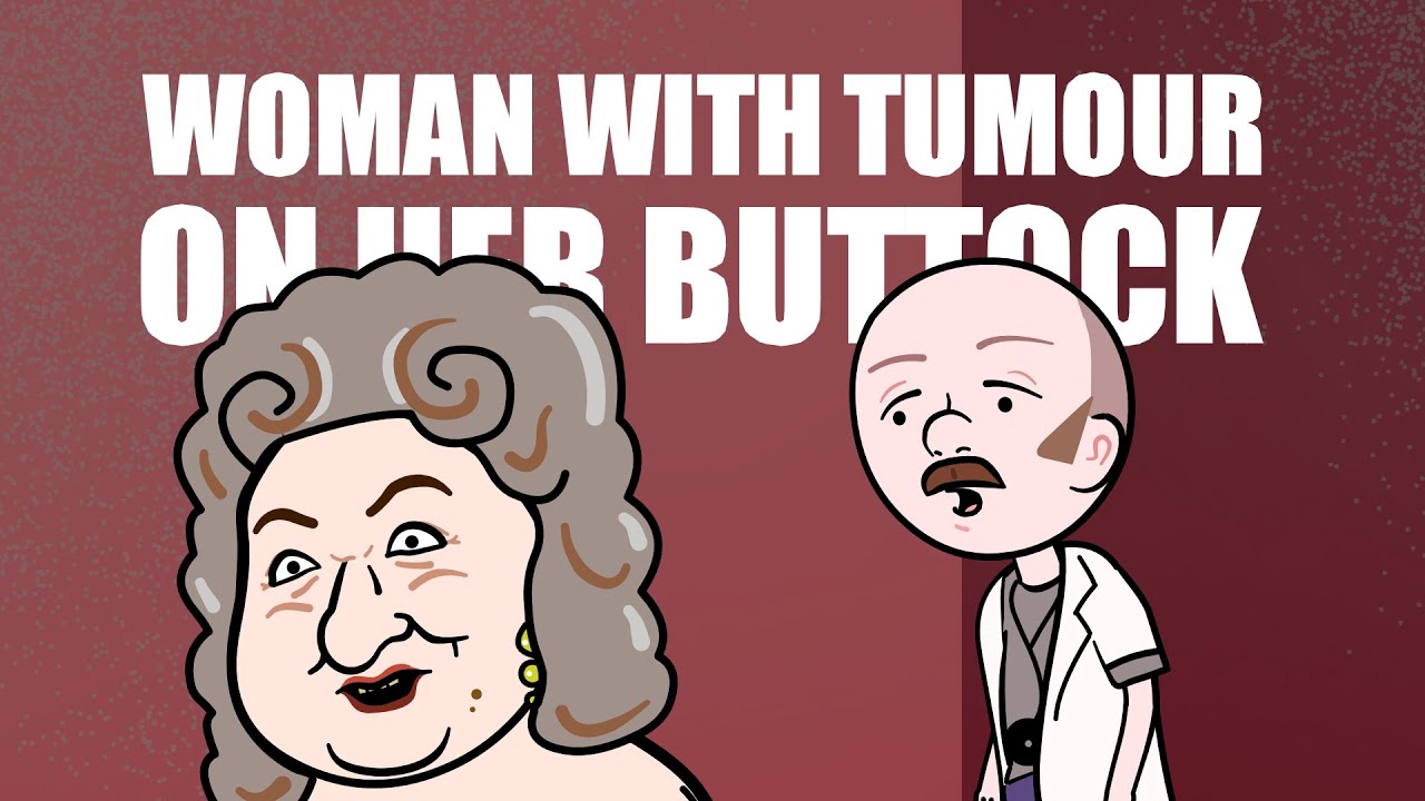 Karl Pilkington: Woman With Tumour On Her Butt | XFM Animation - YouTube