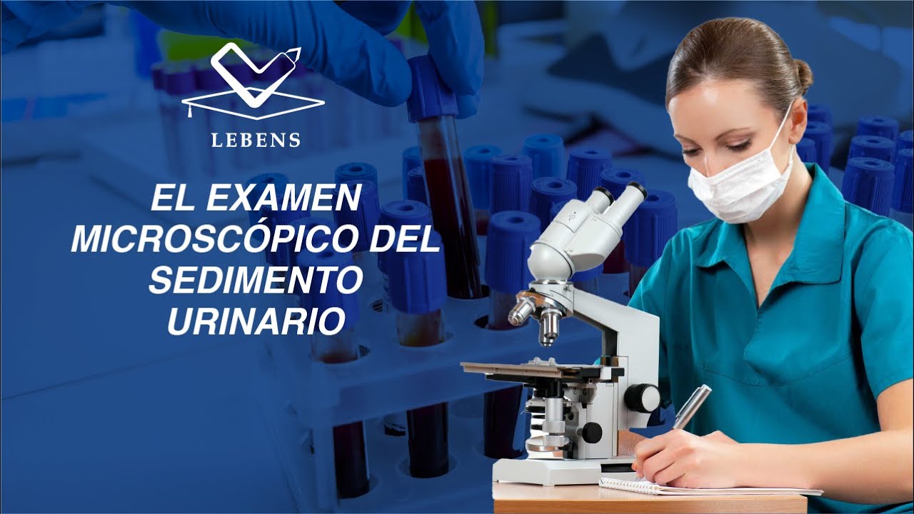 EL EXAMEN MICROSCÓPICO DEL SEDIMENTO URINARIO - YouTube