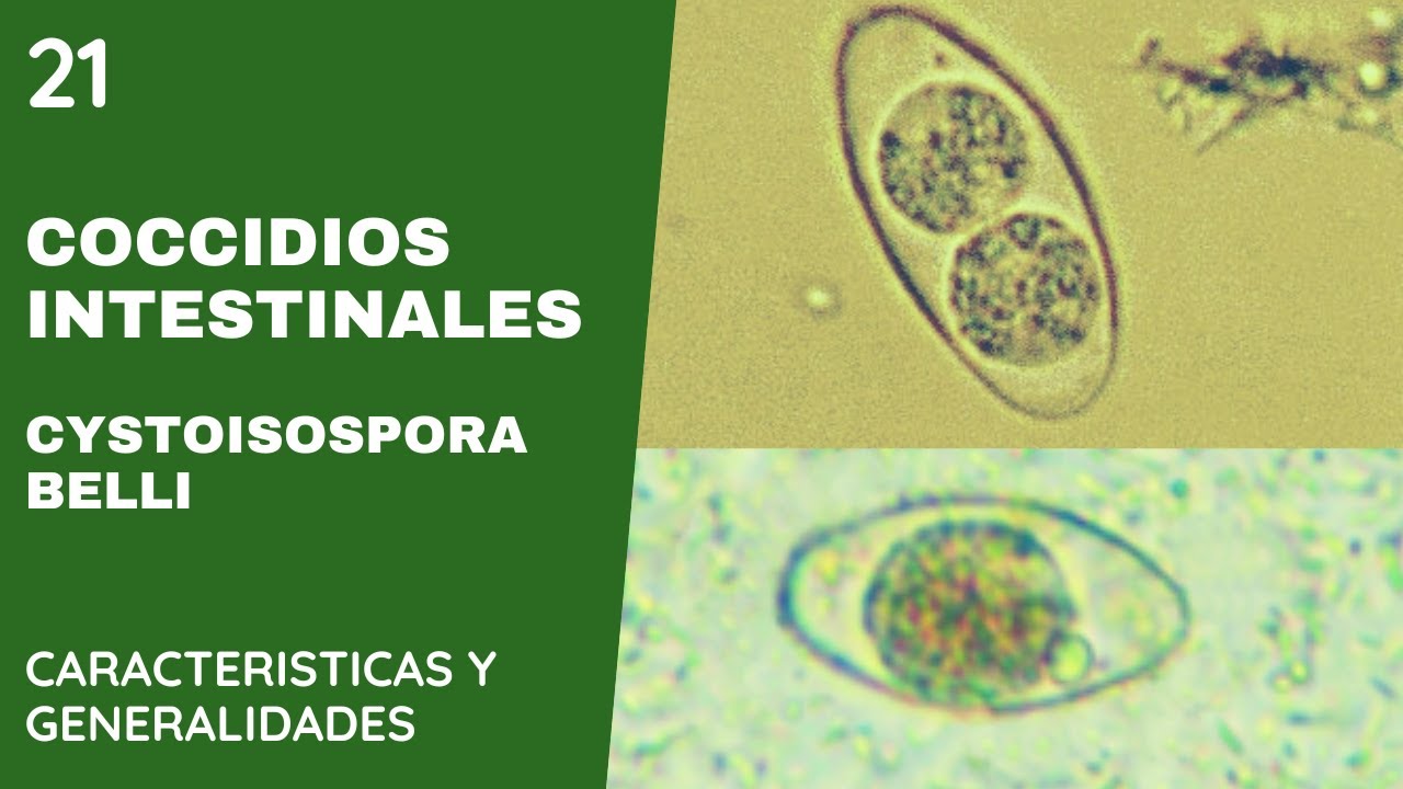 Coccidios Intestinales 21|| Cystoisospora belli || Cystoisosporiasis ...
