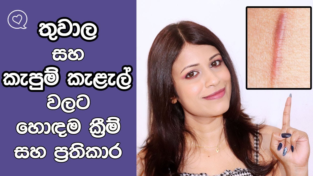 Best Products And Treatments For OLD SCARS - YouTube