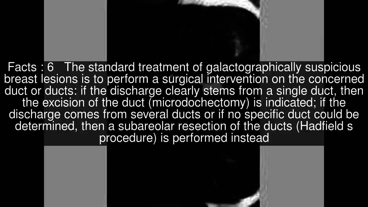 Galactography Top #7 Facts - YouTube