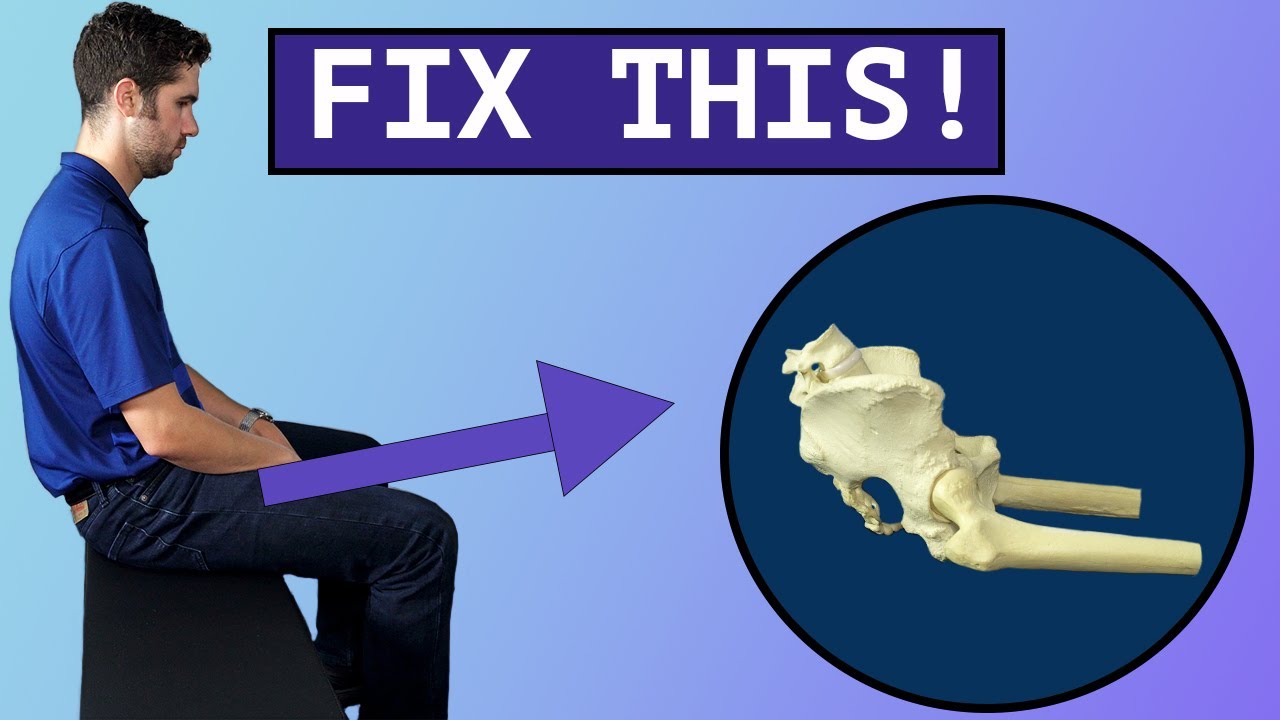 Posterior Pelvic Tilt Correction - Get Rid of Lower Back Pain with ...