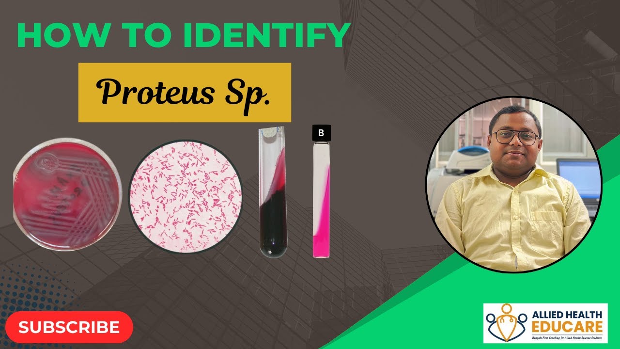 IDENTIFICATION PROCEDURE OF PROTEUS SP (WITH PRACTICAL DEMO) - YouTube