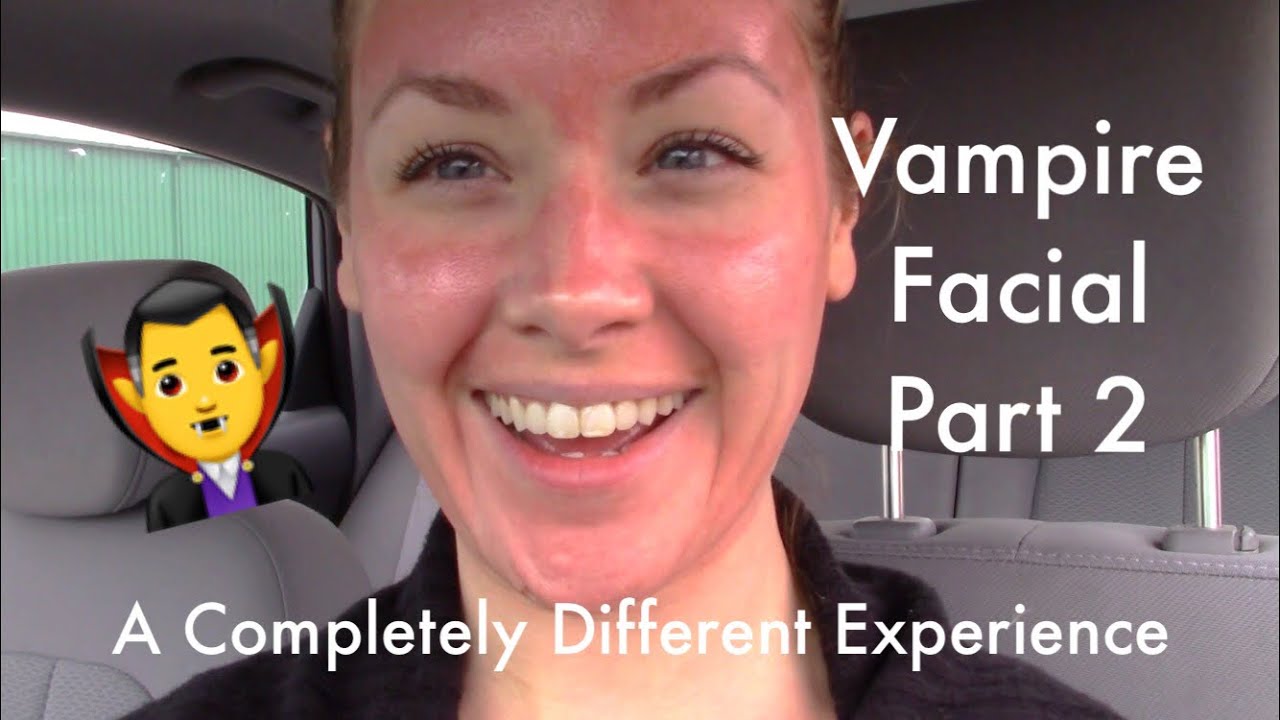 Vampire Facial Part 2: A Completely Different Experience - YouTube