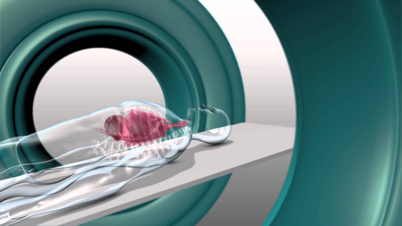 Ingham Institute MRI-Linac Animation - YouTube