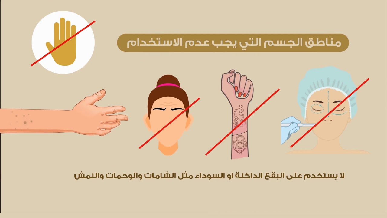 iMooie iG5 - YouTube