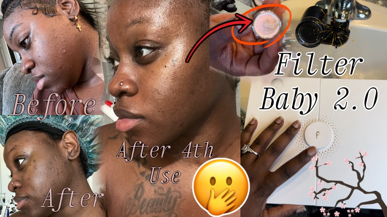 I Got The New Filter Baby 2.0 for glowing skin 😍 *must haves - YouTube