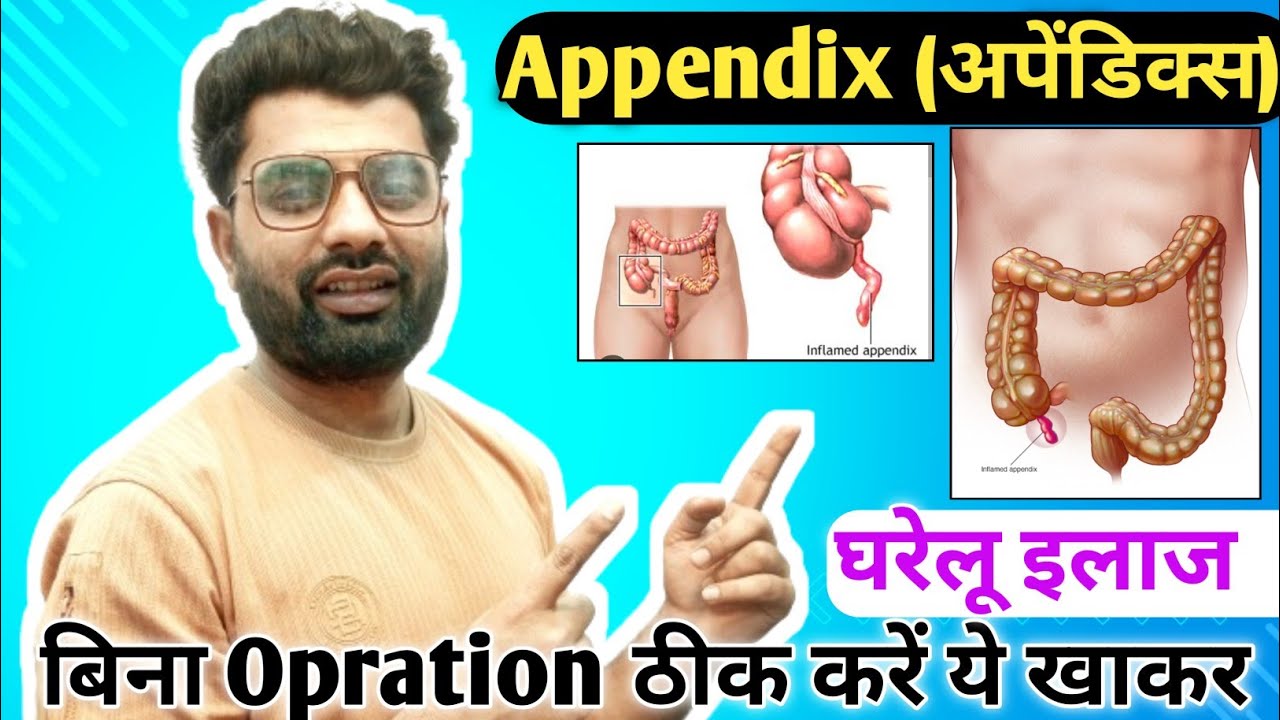 अपेंडिक्स के लक्षण और उपचार | अपेंडिक्स का क्या इलाज है | Appendix Home ...