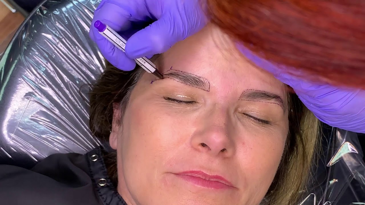 Treatment Lisa Ragsdale - YouTube