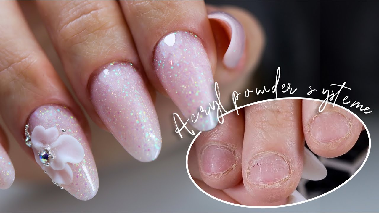 Acryl Système ´Résine ‘ sur Ongles Rongés ! - YouTube