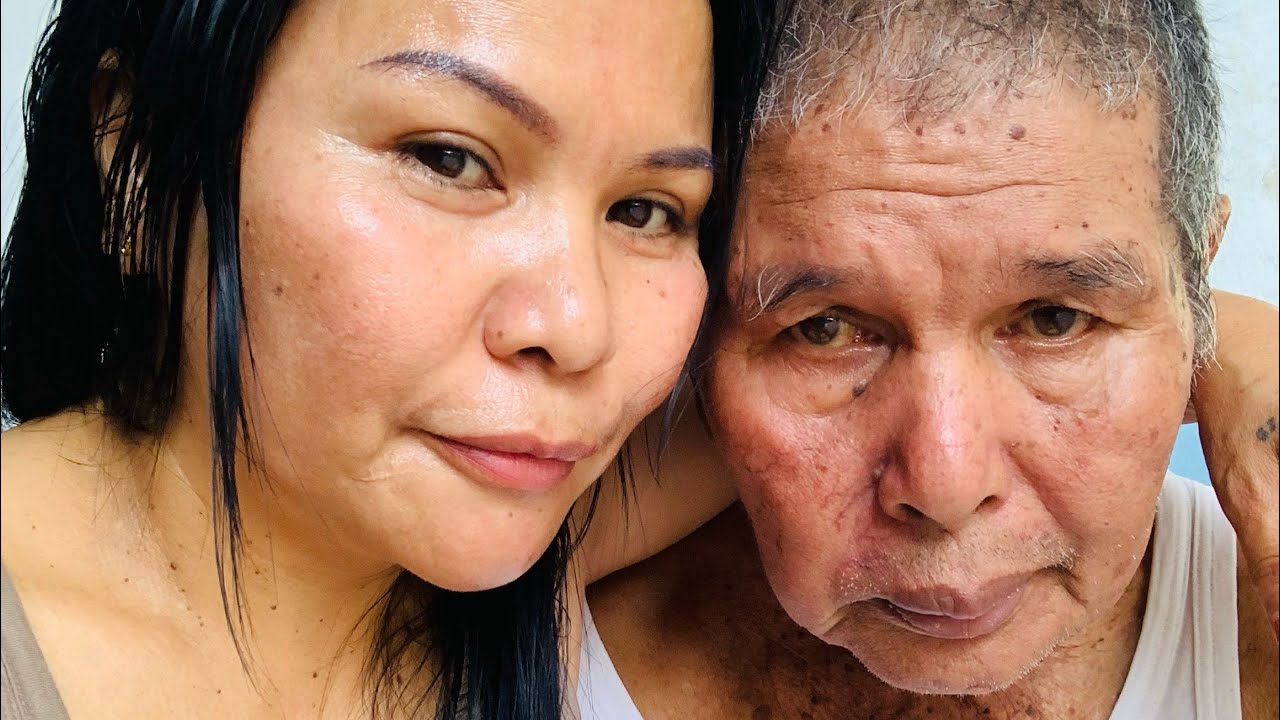 Early selfie with PAPANG and his Surgeon thank you Lord Jesus - YouTube