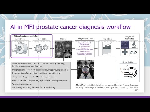Prostate Cancer Detection Using Artifical Inteligence (AI) Software ...