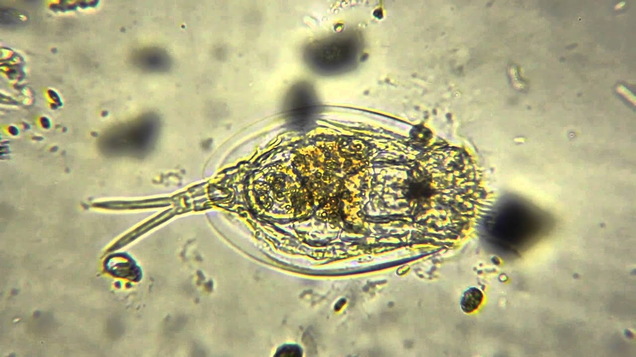 Rotifero Euchlanis sp. - YouTube