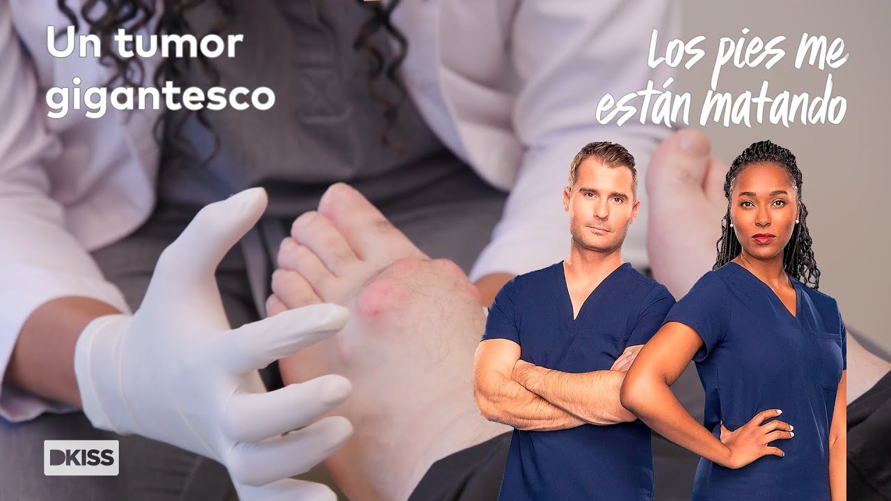 Un tumor gigante en el pie le impide andar sin dolor |Los pies me están ...