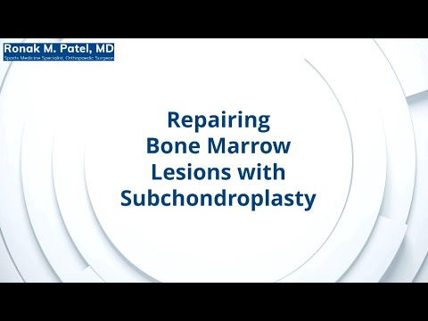 Repairing Bone Marrow Lesions with Subchondroplasty - YouTube