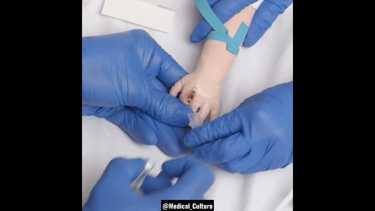 Baby Blood Draw With IV Start 🩸🩸 #shorts @Medical_Culture - YouTube