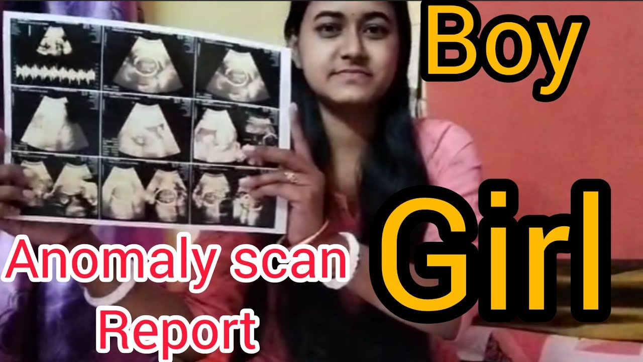 Anomaly Scan Report details ।। Baby boy।। - YouTube