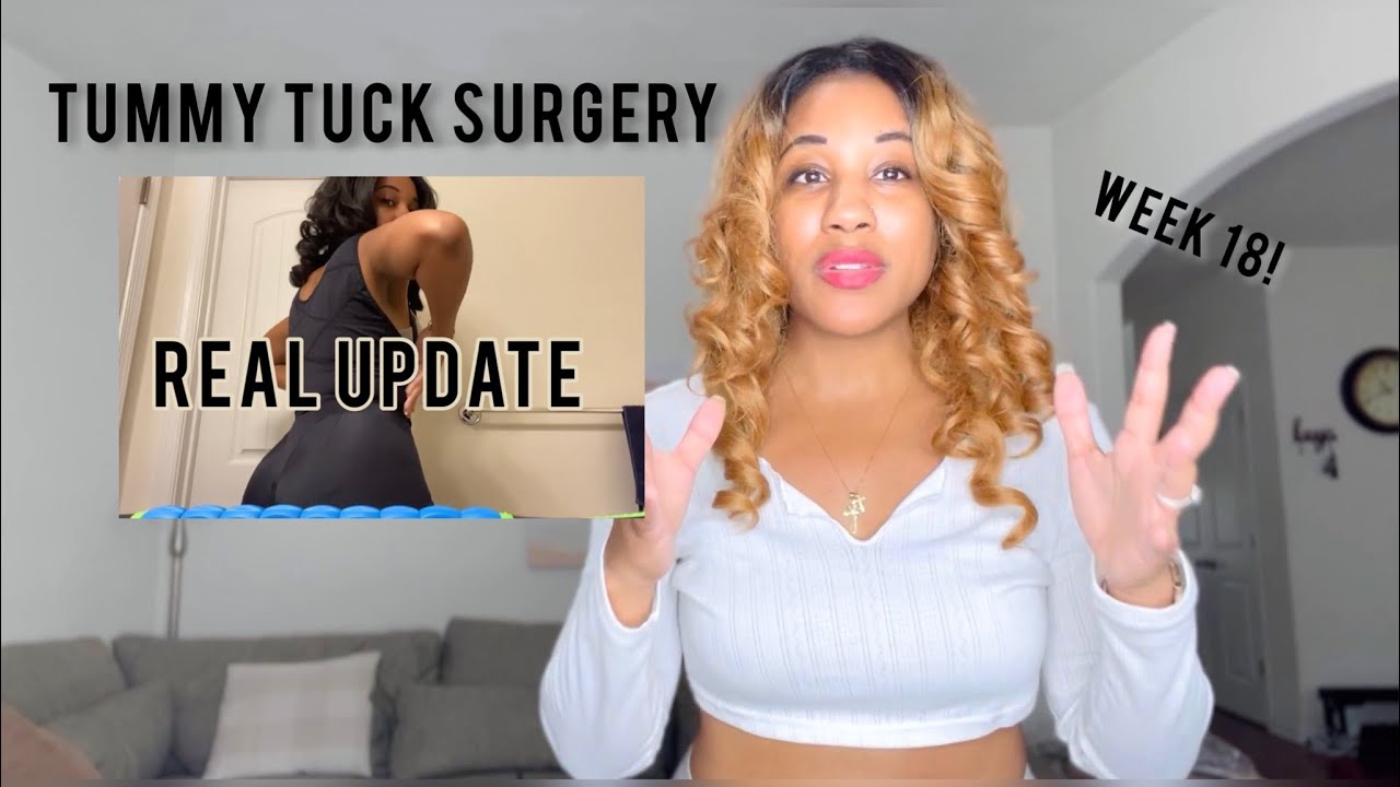 Mommy Makeover Update Scars Swelling Revision Is It Worth It
