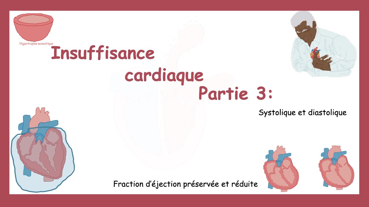 Insuffisance Cardiaque Partie 3: Insuffisance Systolique Et Diastolique ...
