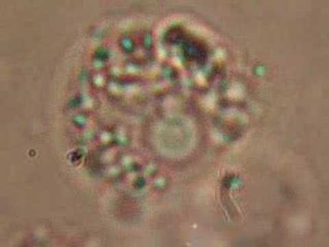 Cell disintegrating - YouTube