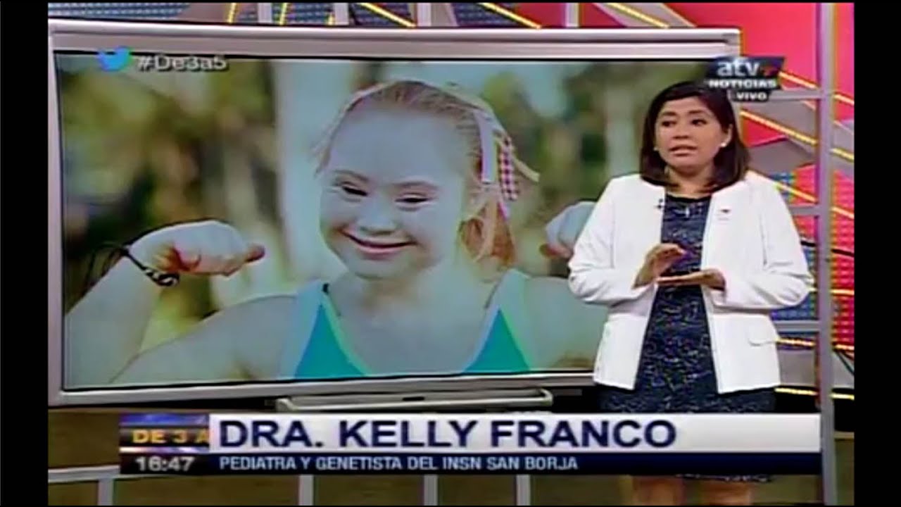 Kelly Franco dialoga sobre el síndrome Down (Canal ATV +) - YouTube