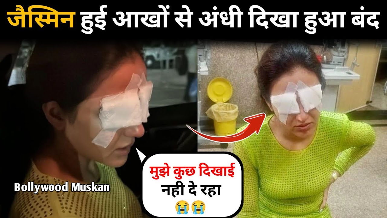 Jasmin Bhasin Lost Eye Vision 😭 After Cornea Got Damaged Because Of ...