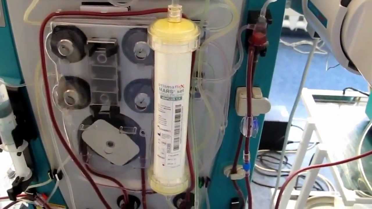 CVVHVHF citrate, x-MARS citrate CVVHDF - YouTube