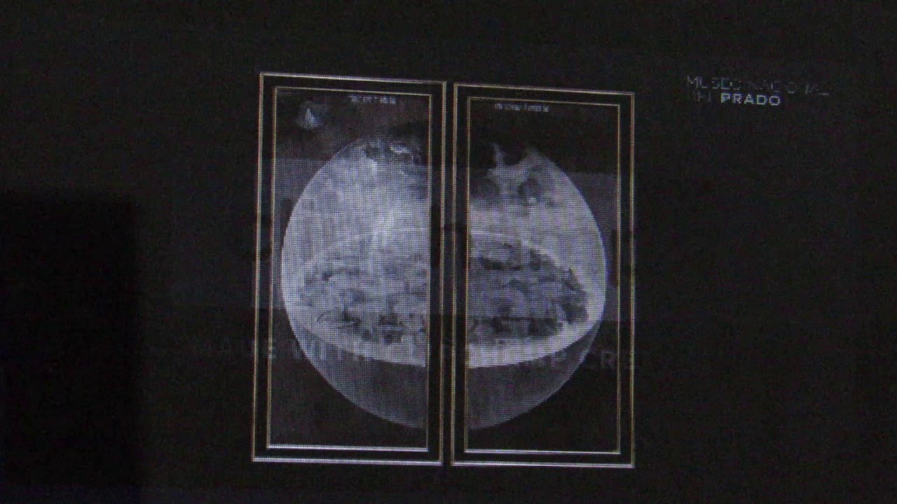 parte final ova1 - YouTube