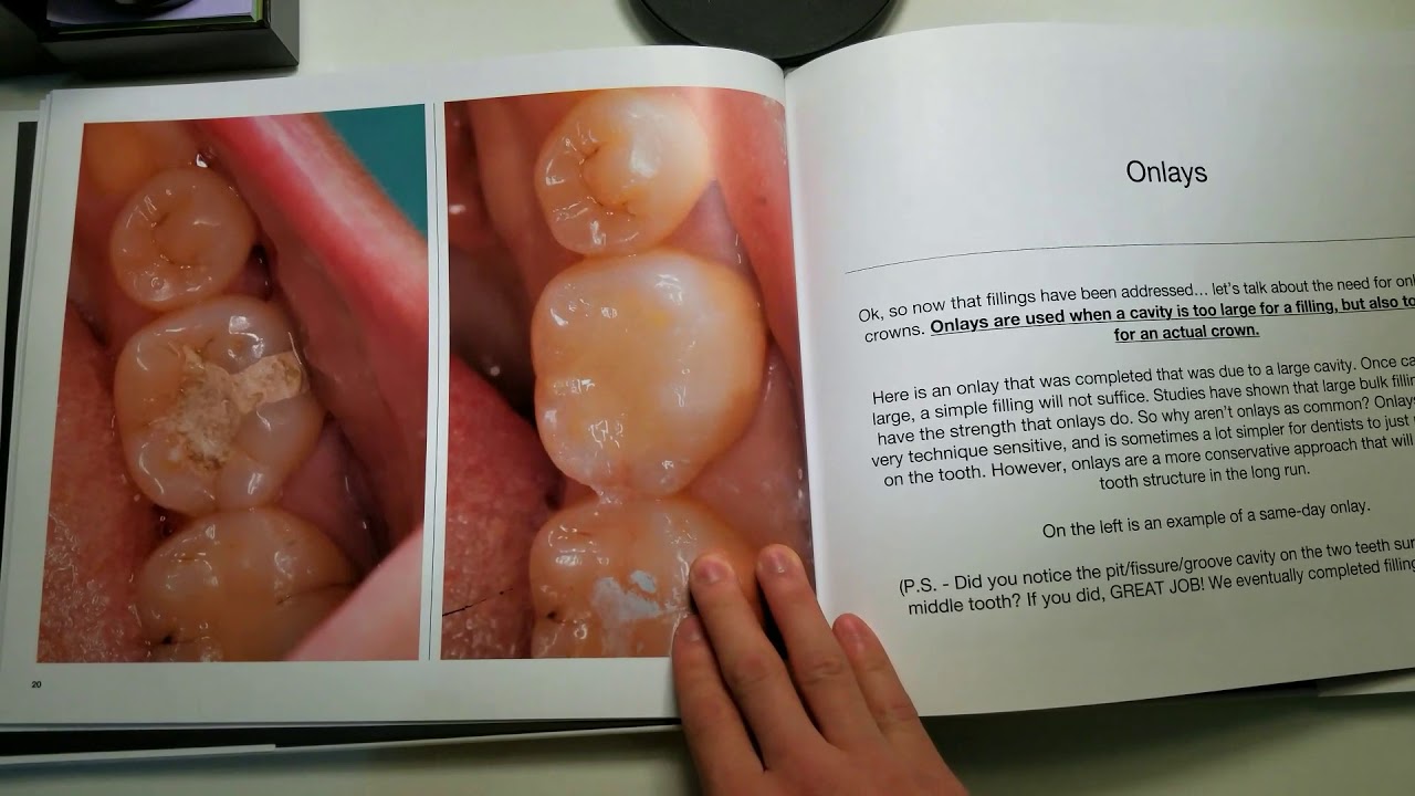 Dr. Nguyen's Dental Book - An Idea for your office - YouTube