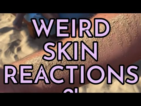 Crazy weird skin reaction with sands ⛱️ - YouTube