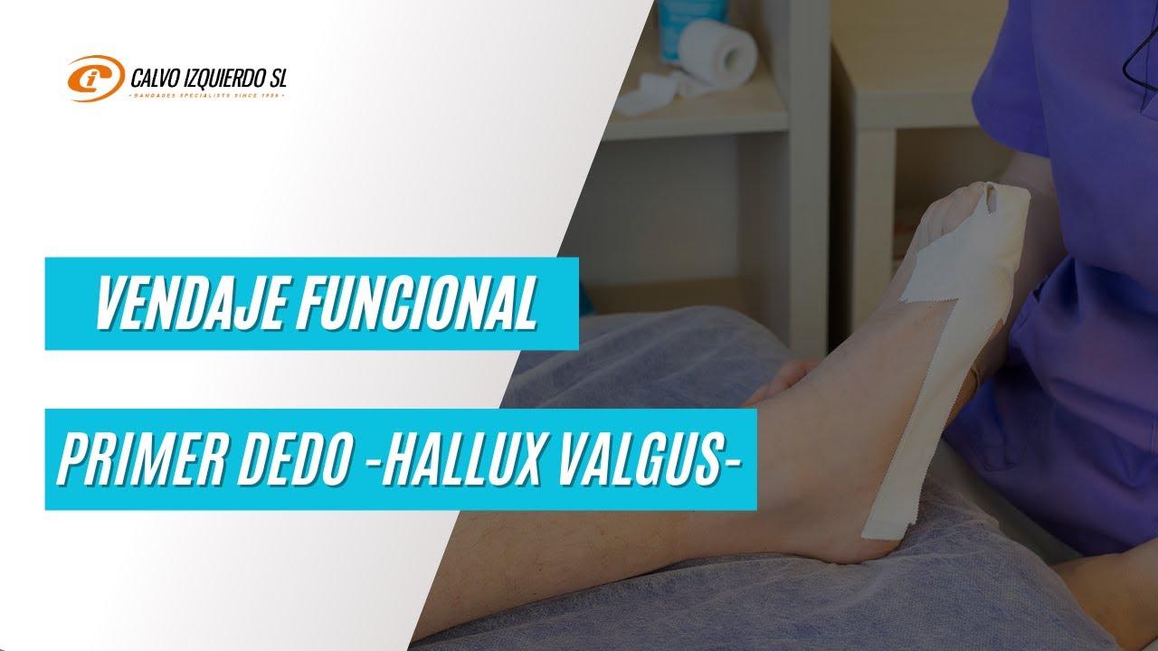 Vendaje funcional para el primer dedo, hallux valgus - YouTube