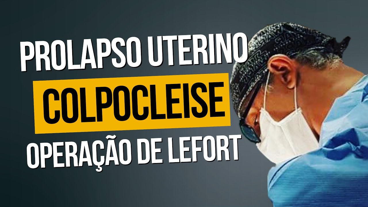 Tratamento do Prolapso Uterino - COLPOCLEISE - Operação de Lefort - YouTube