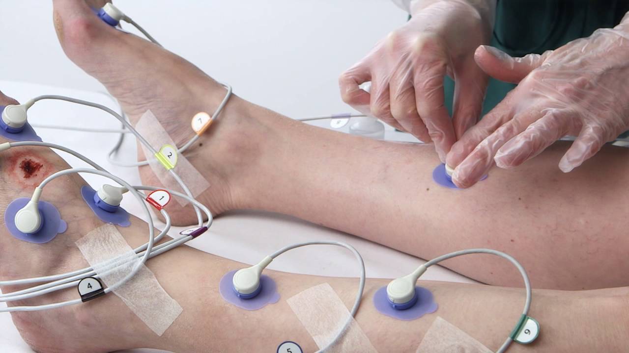 Ossimetria Transcutanea - monitoraggio della tcpO2 usando il PeriFlux ...