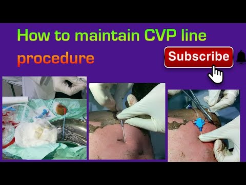 how to maintain cvp line#nursing #nursingcare #medical #nursing proceduretechniques - YouTube