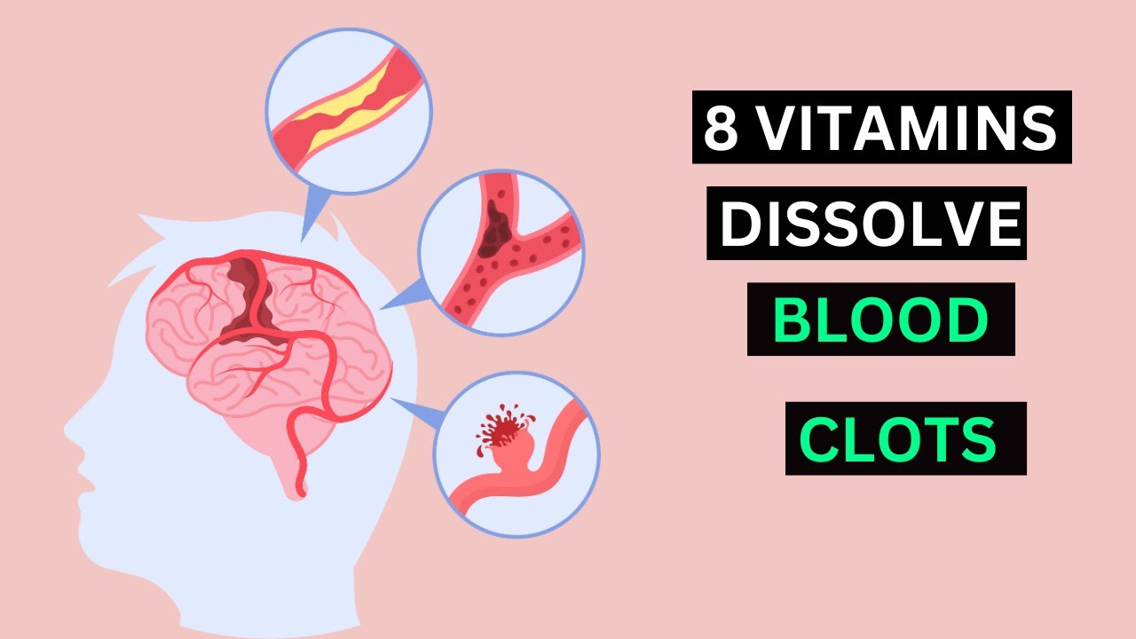 8 Vitamins To DISSOLVE Your BLOOD CLOTS | Health - YouTube