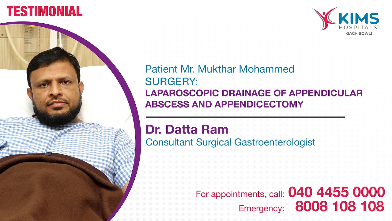 Laparoscopic Drainage of Appendicular ABSCESS and Appendicectomy ...