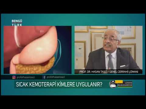 Mide Kanserinin Belirtileri Nelerdir? Prof. Dr. Hasan Taşçı bilgilendiriyor...