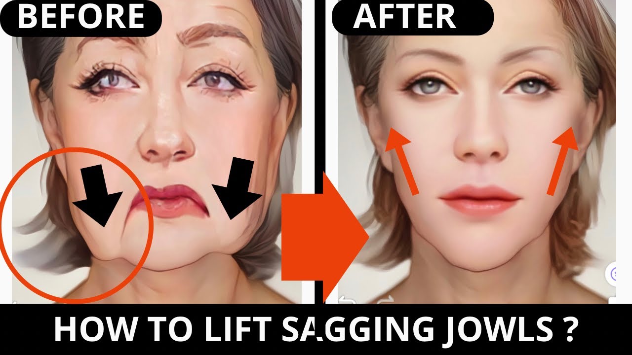 🛑 FACE LIFTING EXERCISES FOR JOWLS, SAGGY SKIN, LAUGH LINES, SAGGY ...