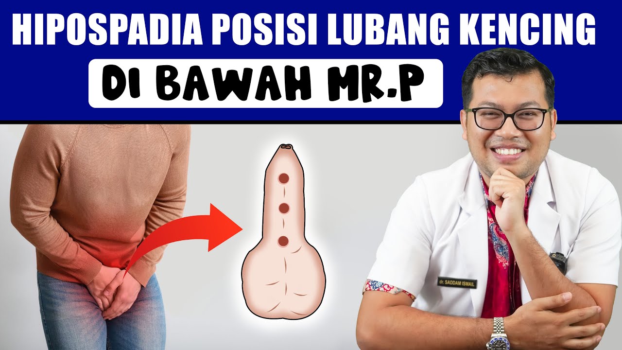 HIPOSPADIA KELAINAN BAWAAN LAHIR PADA LUBANG KENCING PRIA - DOKTER SADDAM ISMAIL - YouTube