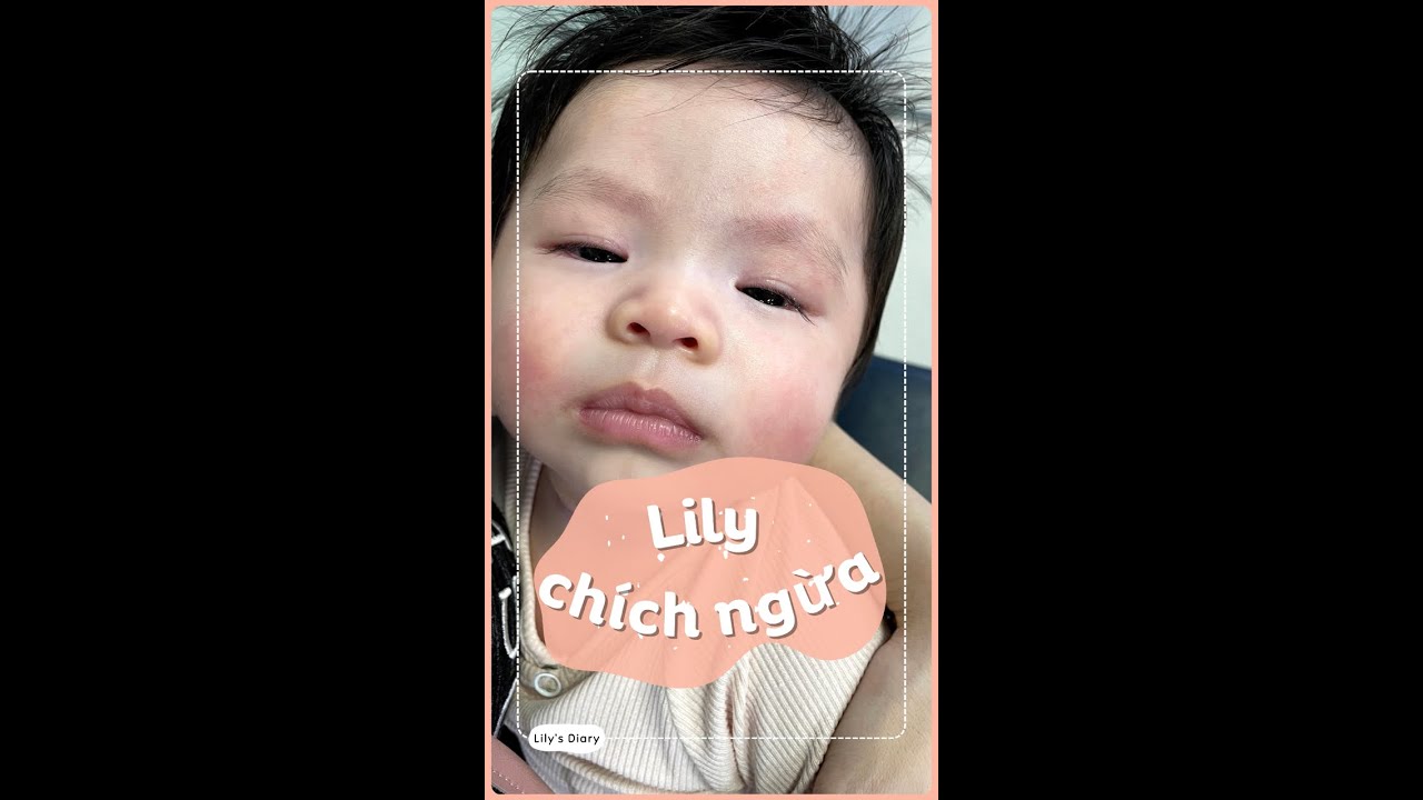 #10 Lily đi chích ngừa #lily3m | Lily got vaccinated | Lily's Diary - YouTube